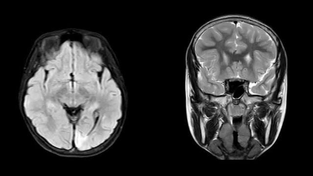 左右に並んでいる脳のMRIの動画｜無料の動画素材サイト「動画AC」