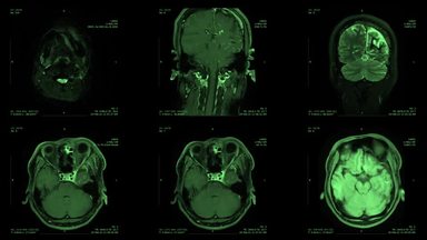 割れたガラス04 - No: 2761804｜写真素材なら「写真AC」無料（フリー）ダウンロードOK
